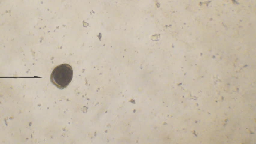Feline Roundworm Toxocara Cati Eggs Veterinary Microscopic Evaluation Of Fecal Sample At 100